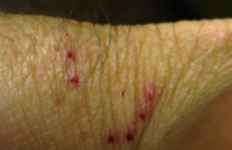 First Aid For Snake Bite: Prevention – Cobras.org